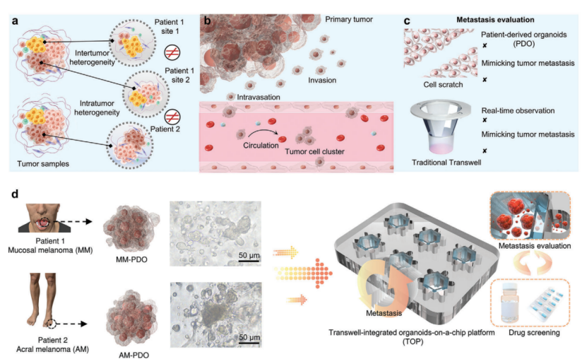 中南大学陈翔陈泽宇赵爽《Small》：Transwell集成化类器官芯片用于模拟肿瘤转移-行业资讯-摩方精密BMF